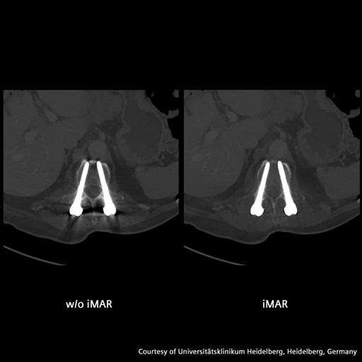 Imar Siemens Healthineers