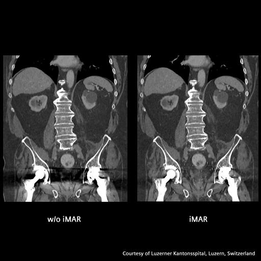 Imar Siemens Healthineers