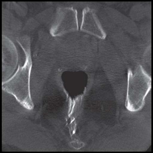 syngo DynaCT - Siemens Healthineers USA