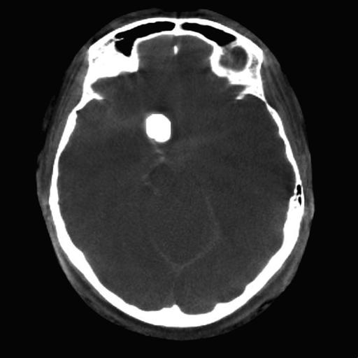 syngo DynaCT - Siemens Healthineers USA