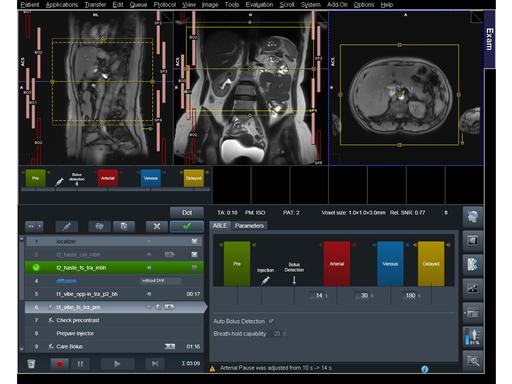 DotGO Workflow - Siemens Healthineers USA