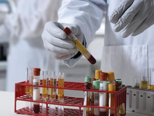 Alzheimer's Disease - Siemens Healthineers