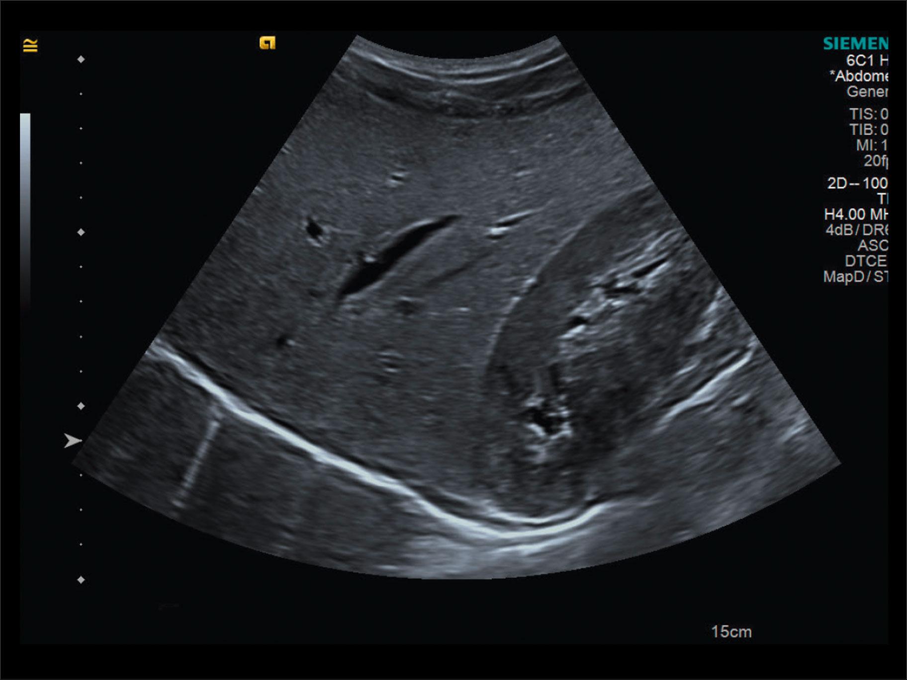 ACUSON S2000 Ultrasound System, HELX Evolution with Touch Control ...