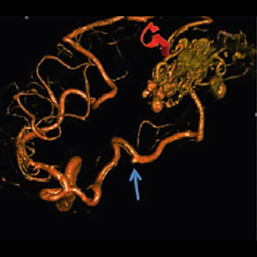 syngo Dyna4D - Siemens Healthineers USA
