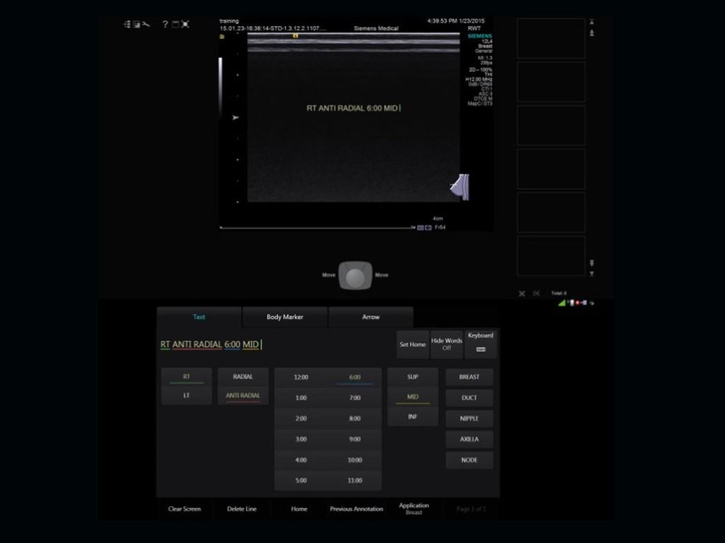 ACUSON S2000 HELX Evolution - Siemens Healthineers Japan