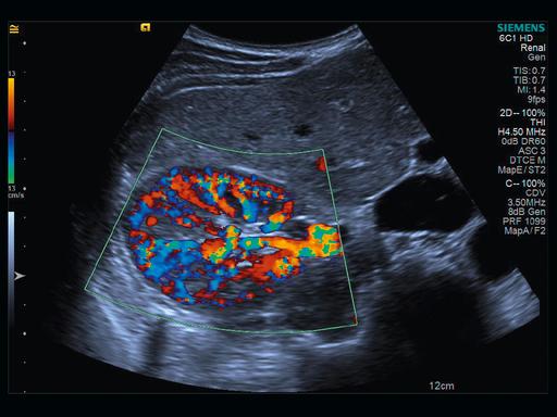 ACUSON S Family of Ultrasound Systems, HELX Evolution with Touch ...