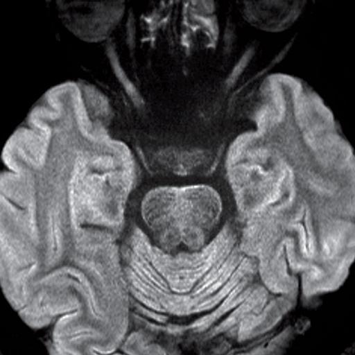 MR Neuro Imaging - MRI Neurology - Siemens Healthineers USA