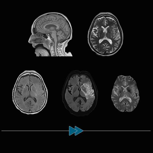 MR Neuro Imaging - MRI Neurology - Siemens Healthineers USA