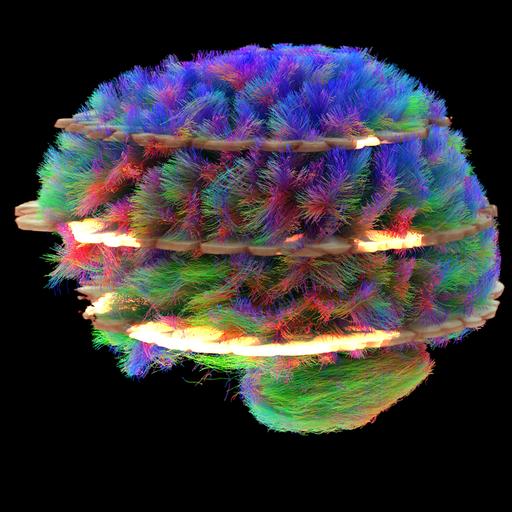 MR Neuro Imaging - MRI Neurology - Siemens Healthineers USA