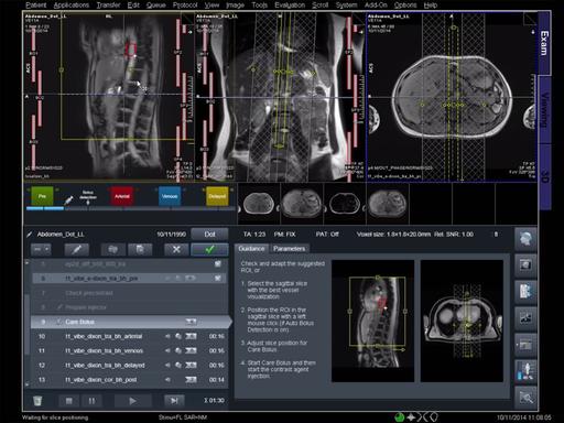 DotGO Workflow - Siemens Healthineers USA