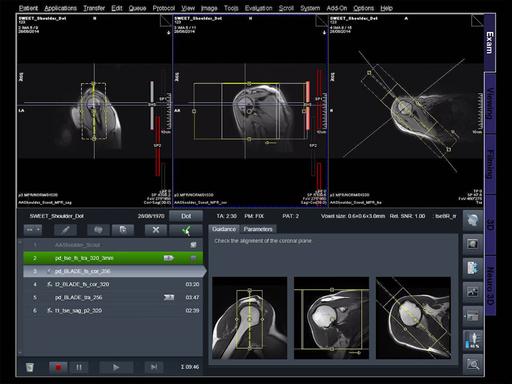 DotGO Workflow - Siemens Healthineers USA