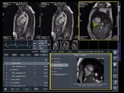 DotGO Workflow - Siemens Healthineers USA