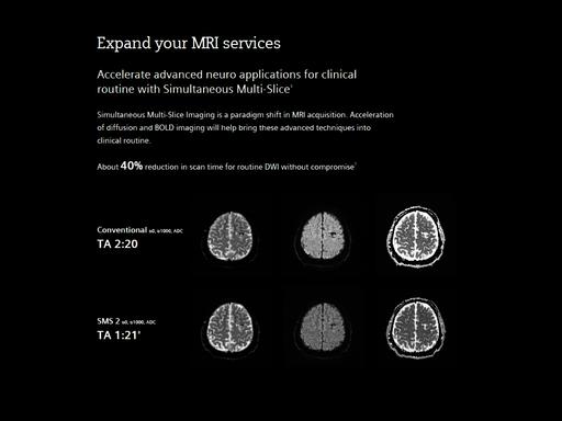 MAGNETOM Aera eco - Siemens Healthineers USA