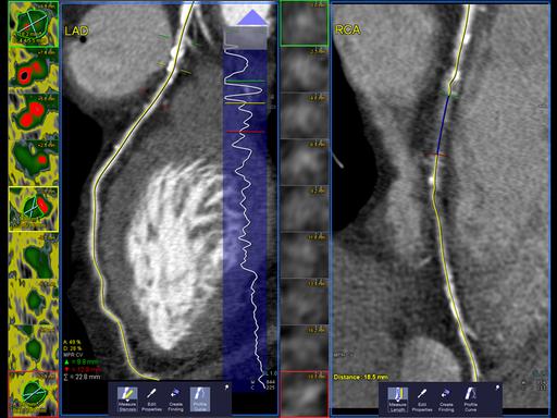 syngo CTO Guidance - Siemens Healthineers