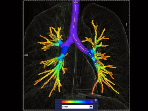 Пакет приложений для диагностики в онкологии - Siemens Healthineers Russia