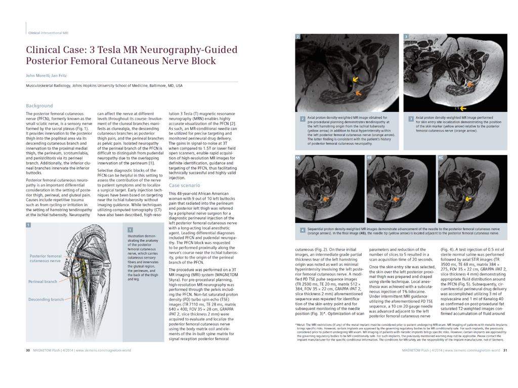 Clinical article and talks on Neurography