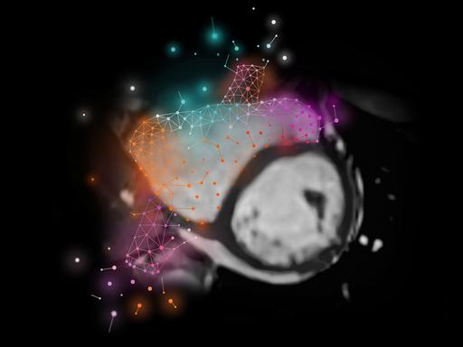 Magnetic Resonance Imaging - Siemens Healthineers USA