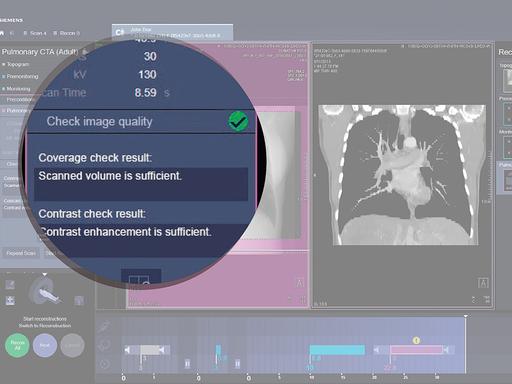 SOMATOM go.Up for Radiation Therapy Imaging - Siemens Healthineers USA