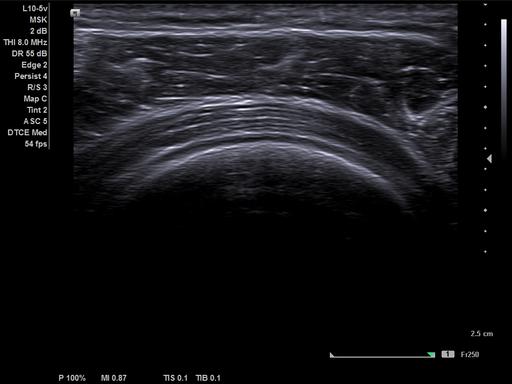 ACUSON NX2 Series Ultrasound System - Siemens Healthineers USA