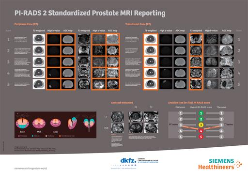 Order your MRI Poster