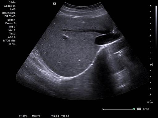 ACUSON NX2 Series Ultrasound System - Siemens Healthineers USA