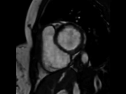 MAGNETOM Vida - Siemens Healthineers Canada