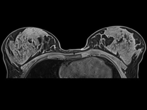 MAGNETOM Vida - Siemens Healthineers Canada