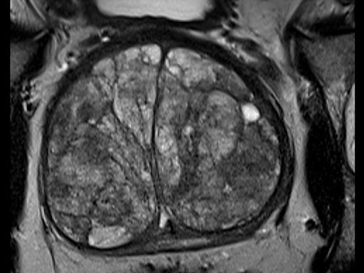 MAGNETOM Vida - Siemens Healthineers Canada