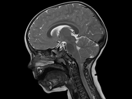 MAGNETOM Vida - Siemens Healthineers Canada