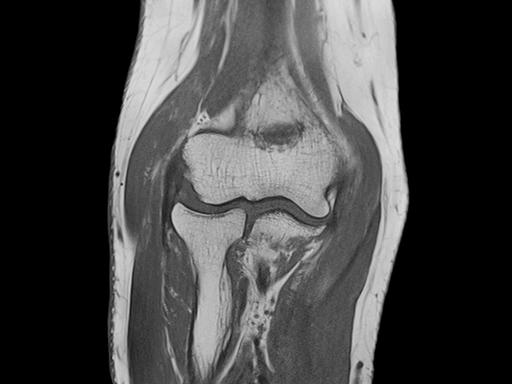 MAGNETOM Vida - Siemens Healthineers Canada