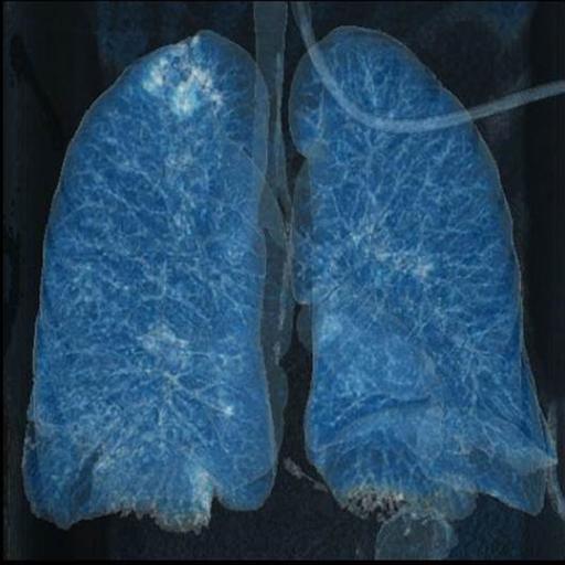 CARE Right - Committed to the Right Dose in CT