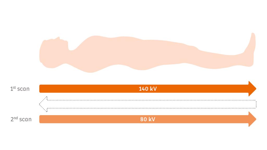 Get further. With True Dual Energy. - Siemens Healthineers India
