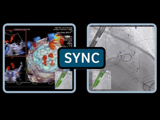 Angiography - Clinical Software Applications - Siemens Healthineers