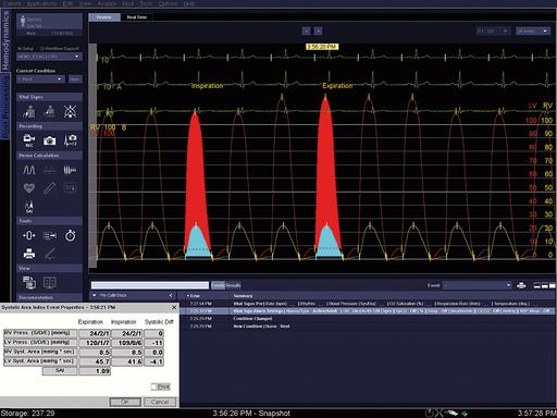 Sensis Vibe - Siemens Healthineers USA