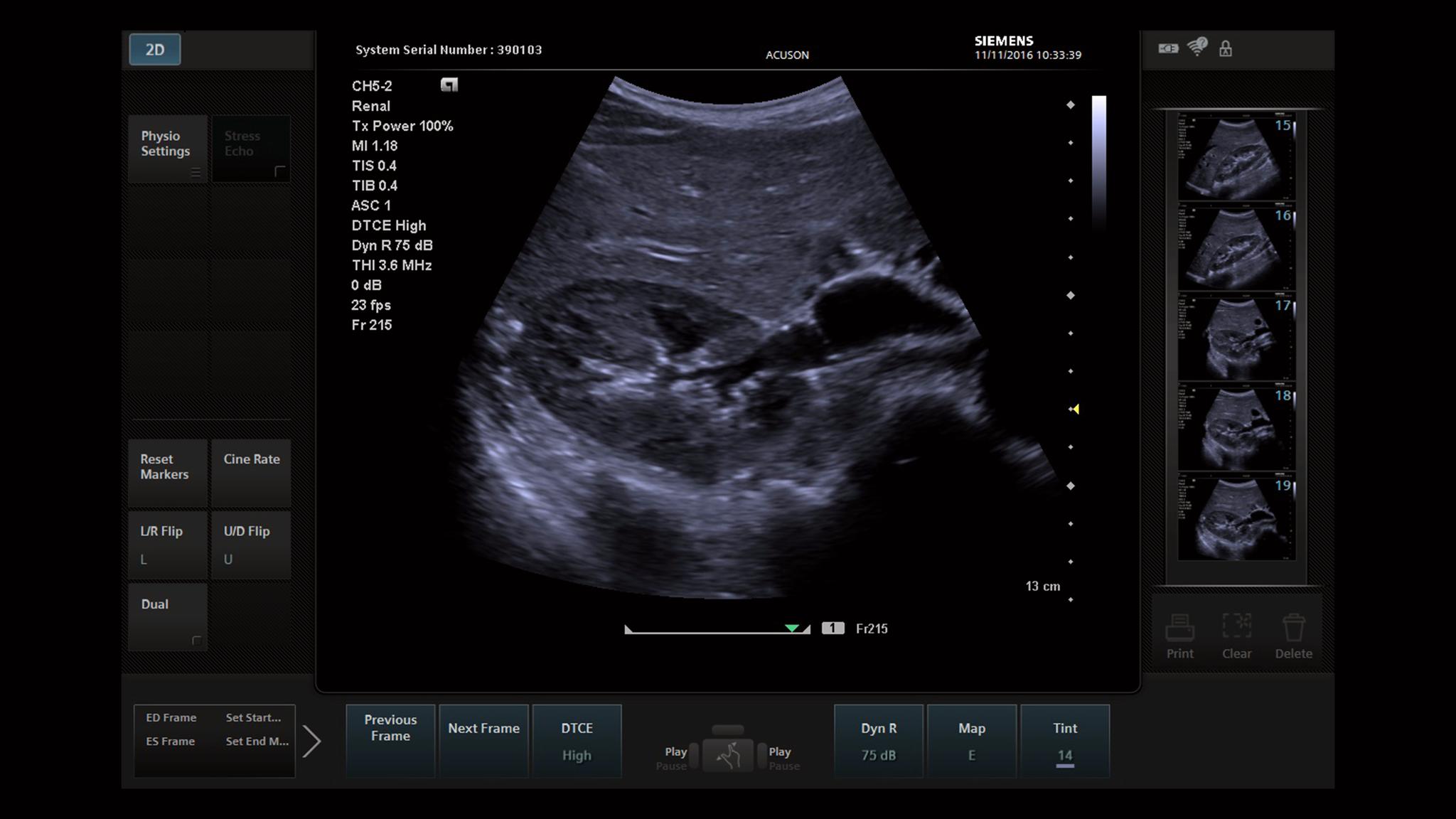 ACUSON P500 Ultrasound System - Siemens Healthineers USA