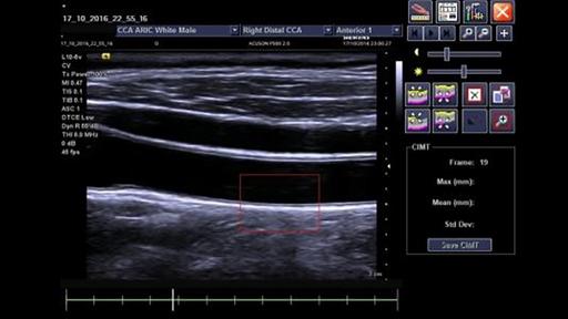 ACUSON P500 Ultrasound System - Siemens Healthineers USA
