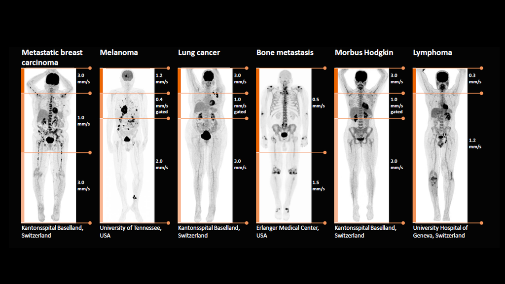 Biograph Horizon Flow edition - Siemens Healthineers Brasil
