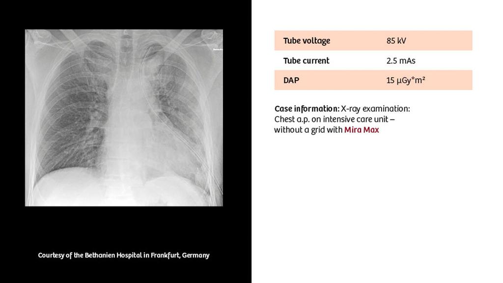 The Right Approach to Radiation Dose Management - Siemens Healthineers