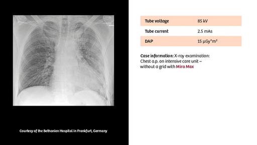 The Right Approach to Radiation Dose Management - Siemens Healthineers