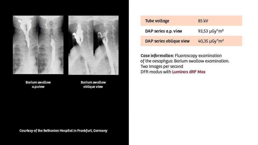 The Right Approach to Radiation Dose Management - Siemens Healthineers