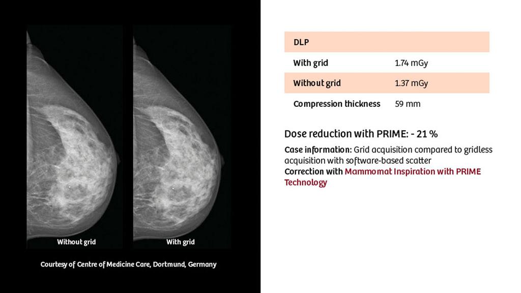 The Right Approach to Radiation Dose Management - Siemens Healthineers