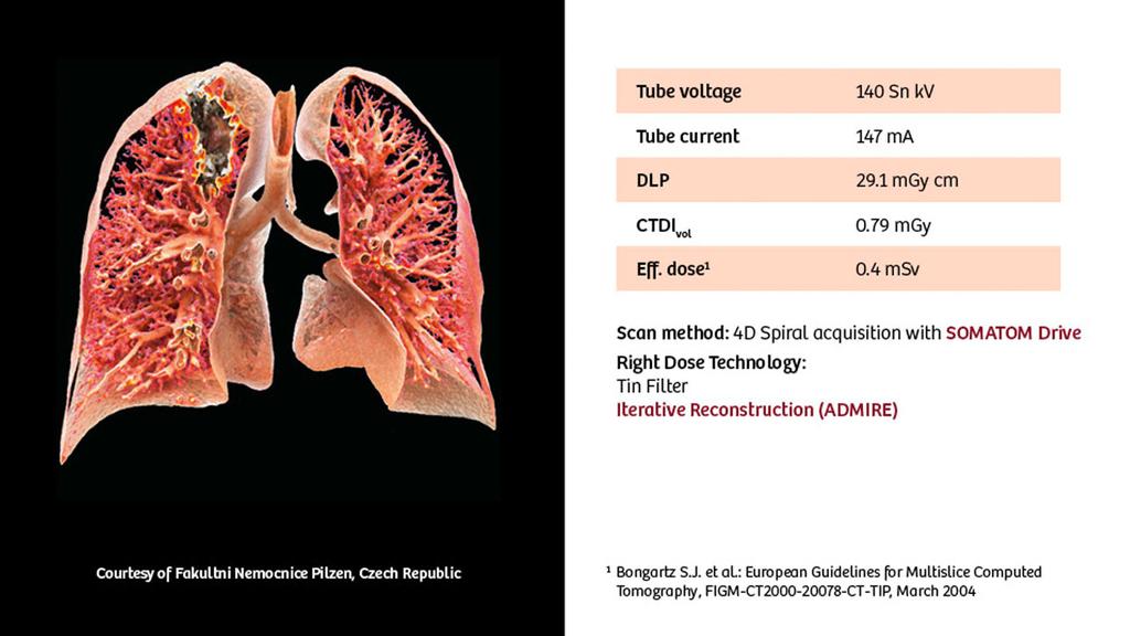 The Right Approach to Radiation Dose Management - Siemens Healthineers