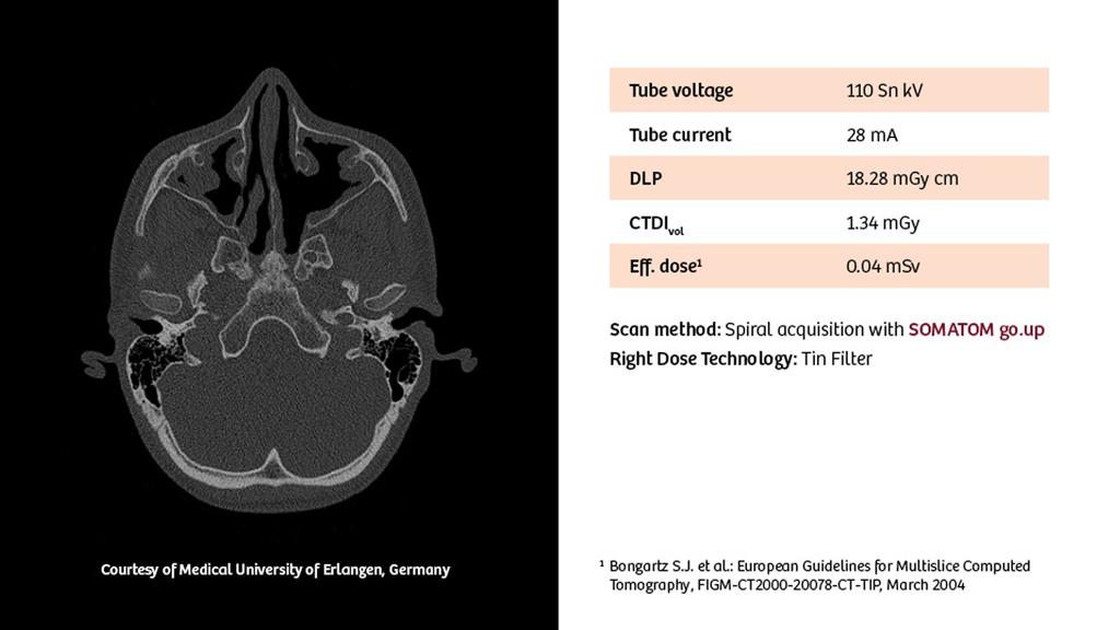 The Right Approach to Radiation Dose Management - Siemens Healthineers