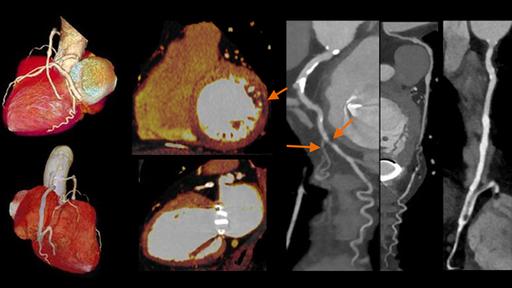 What is Dual Source Dual Energy? - Siemens Healthineers USA