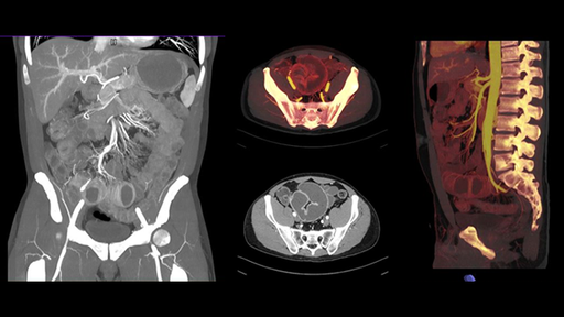What is Dual Source Dual Energy? - Siemens Healthineers USA