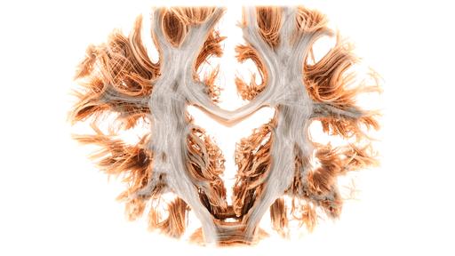 syngo.via Cinematic Rendering VRT - Siemens Healthineers USA