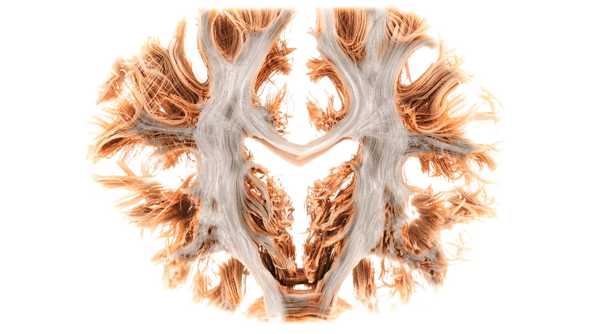 syngo.via Cinematic Rendering VRT - Siemens Healthineers USA