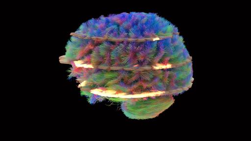 syngo.via Cinematic Rendering VRT - Siemens Healthineers USA