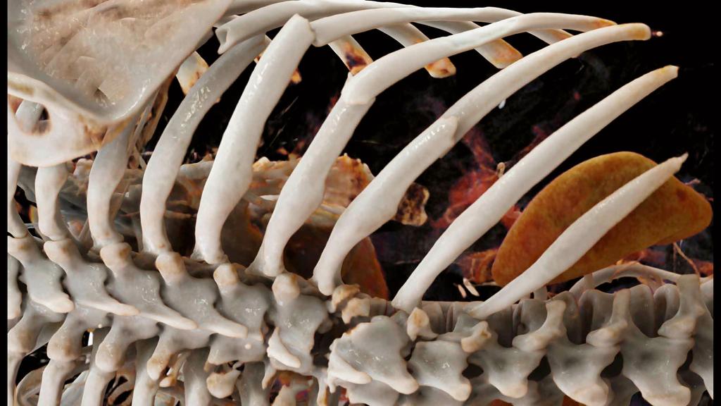 syngo.via Cinematic Rendering VRT - Siemens Healthineers USA