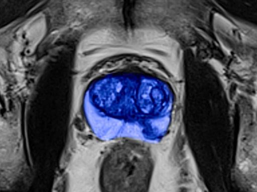 Magnetic Resonance Imaging - Siemens Healthineers USA